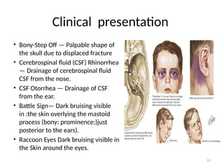 Traumatic brain injury description and managements | PPT