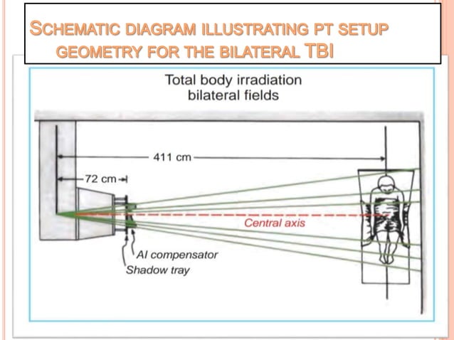 Total Body Irradiation Ppt For Radiology Pptx