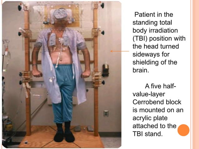 Total body irradiation ppt for radiology.pptx