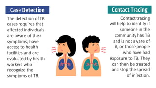 TB in Pakistan.pdf