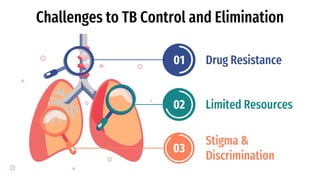 TB in Pakistan.pdf