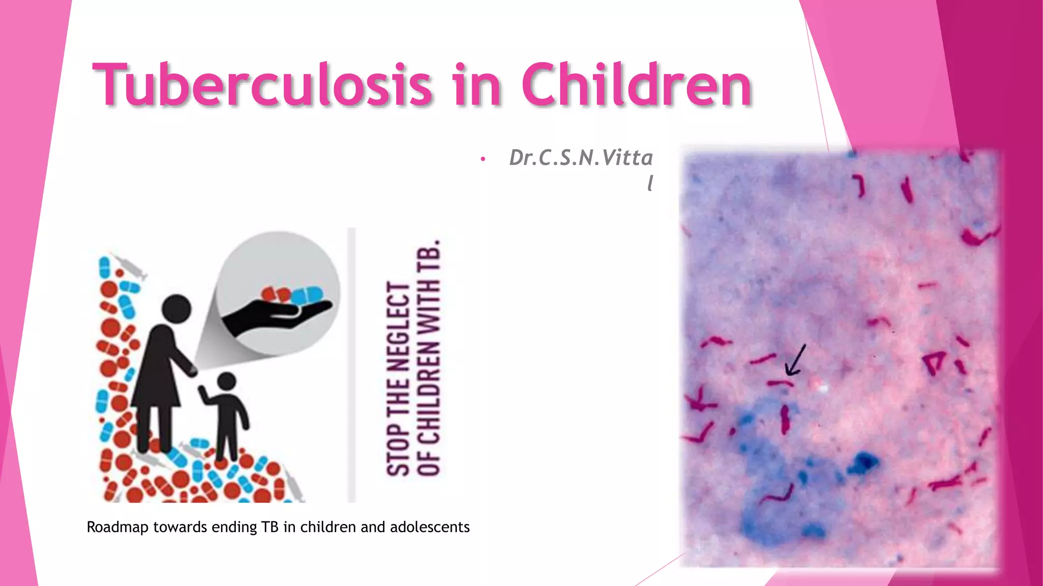 TB in pediatrics | PPTX