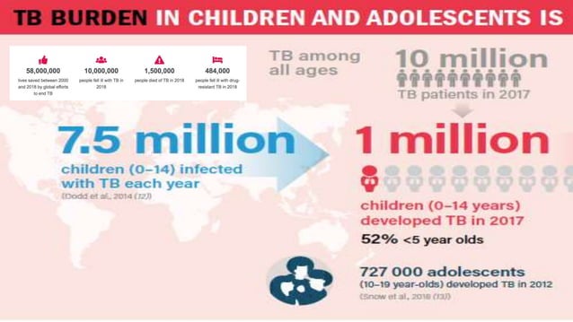 TB in pediatrics | PPTX