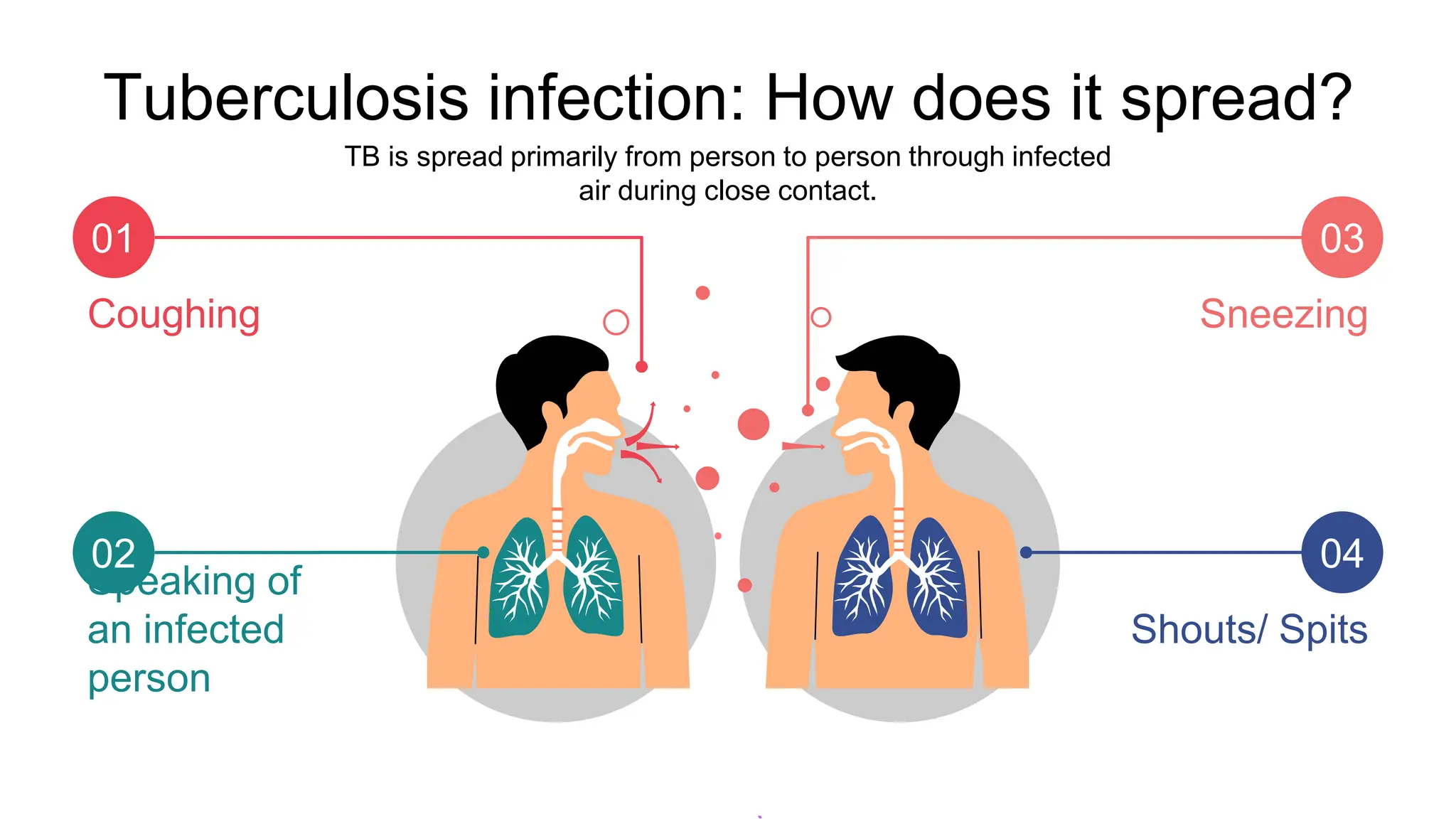 Pulmonary Tuberculosisi in the workplace | PPTX