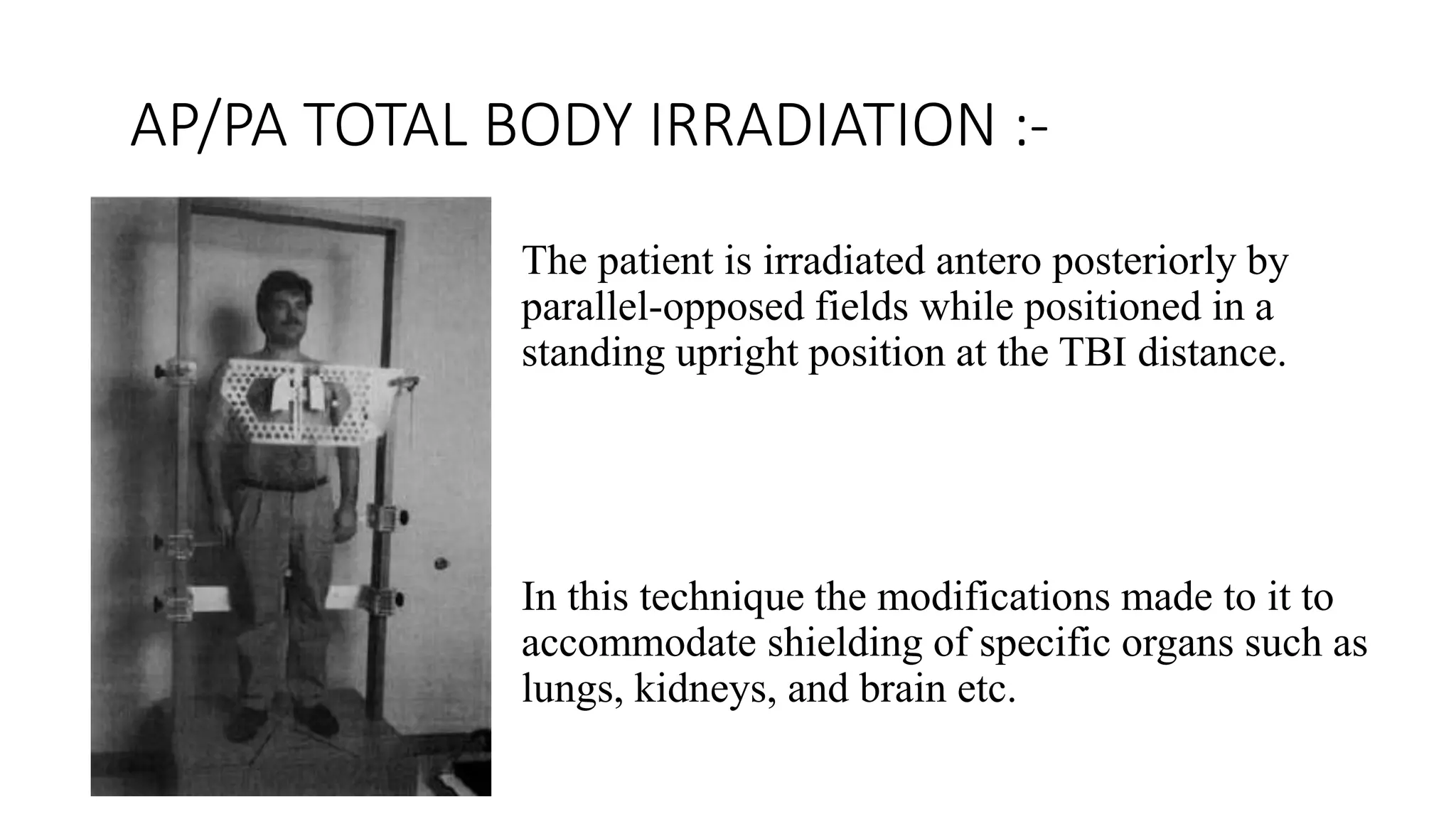 Total Body Irradiation (TBI) Planning | PPTX