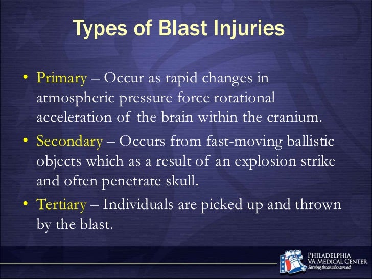 Tbi powerpoint for class 2