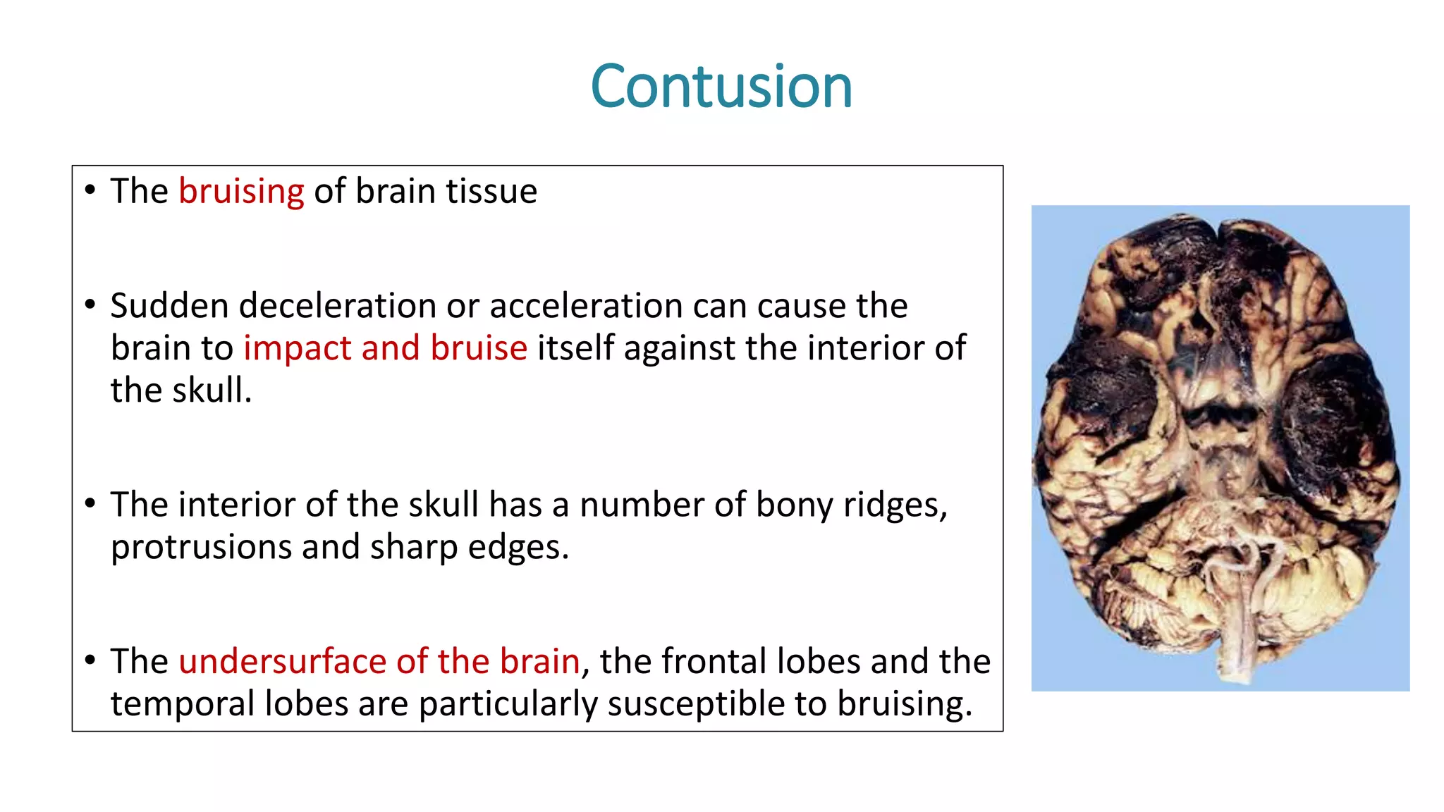 Traumatic Brain Injury to temporal lobe and cognitive rehabilitation | PPT
