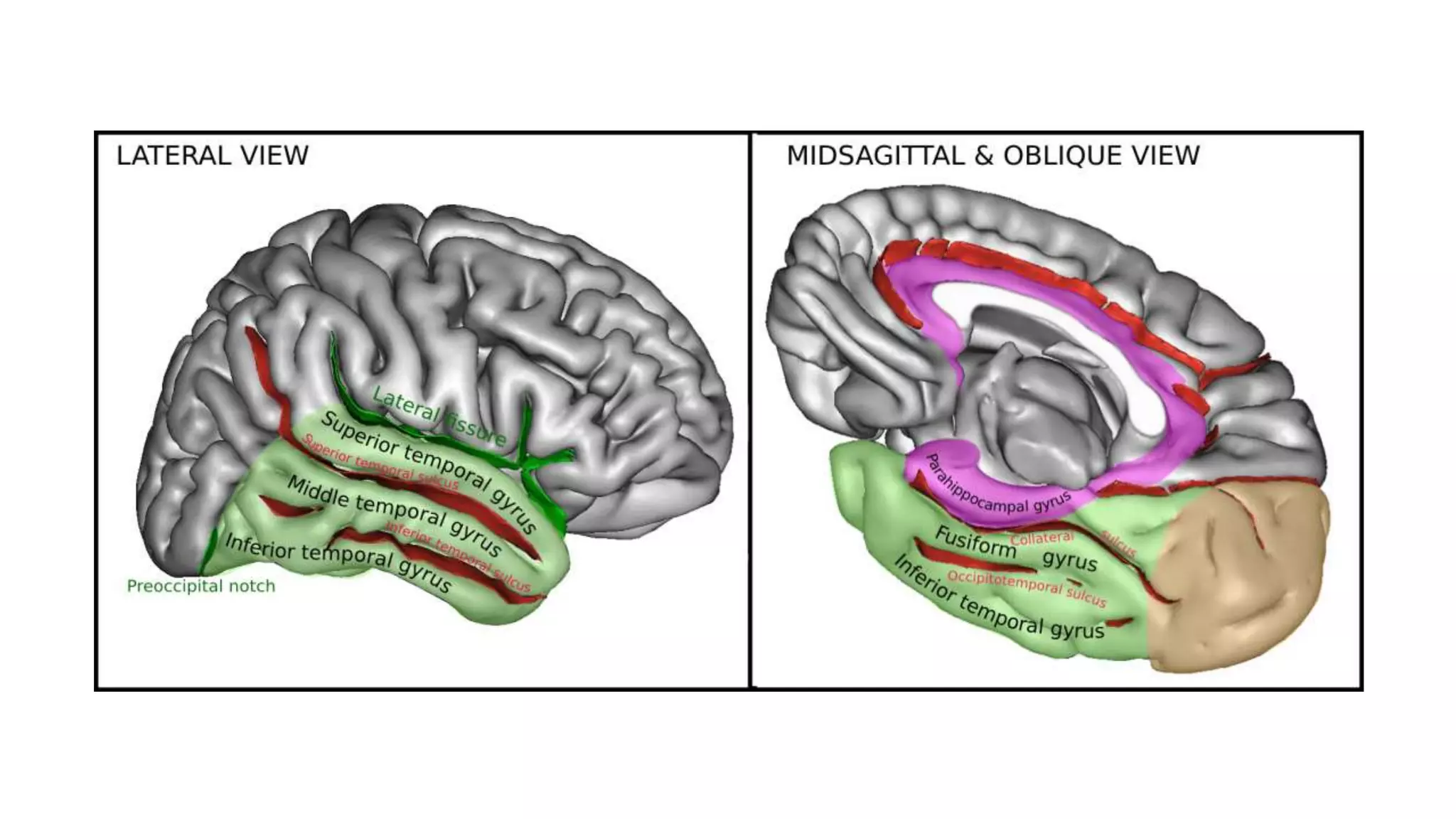 Traumatic Brain Injury to temporal lobe and cognitive rehabilitation | PPT