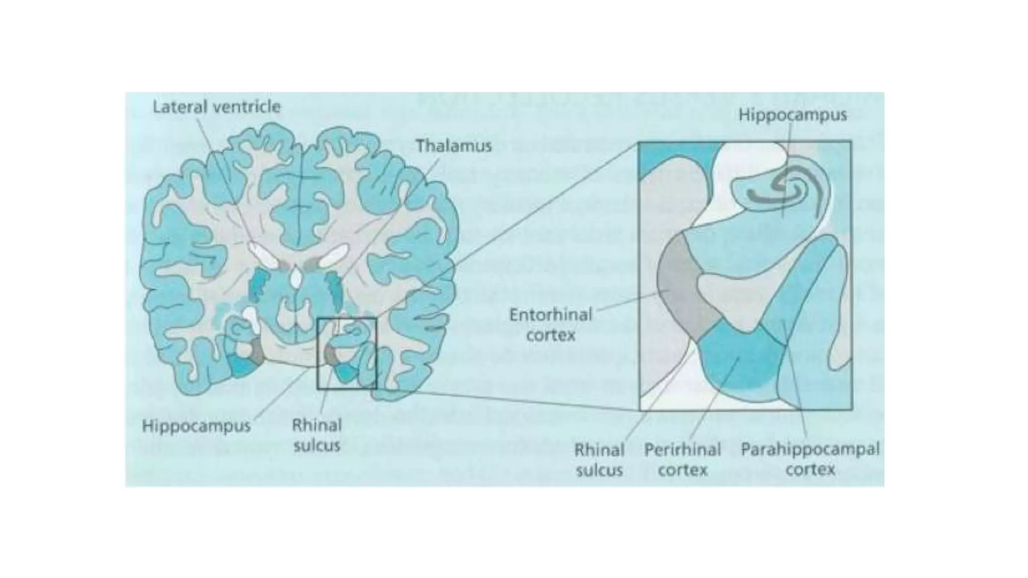 Traumatic Brain Injury to temporal lobe and cognitive rehabilitation | PPT