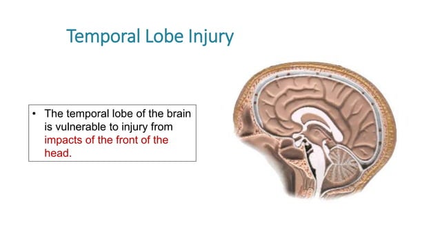 Traumatic Brain Injury to temporal lobe and cognitive rehabilitation | PPT