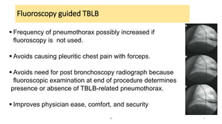 Tblb narthanan tapcon 2019 | PPTX