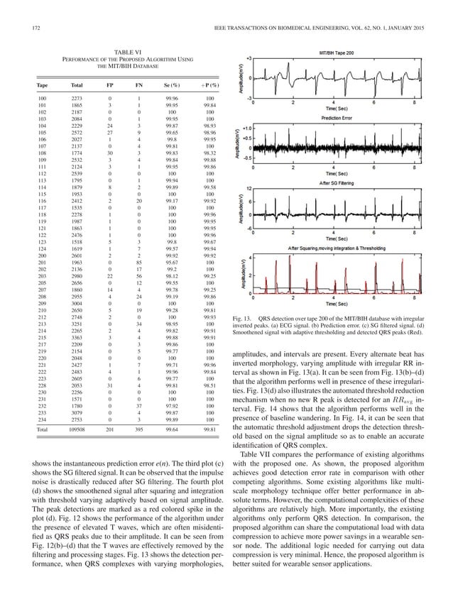 A Joint QRS Detection and Data Compression Scheme for Wearable Sensors | PDF