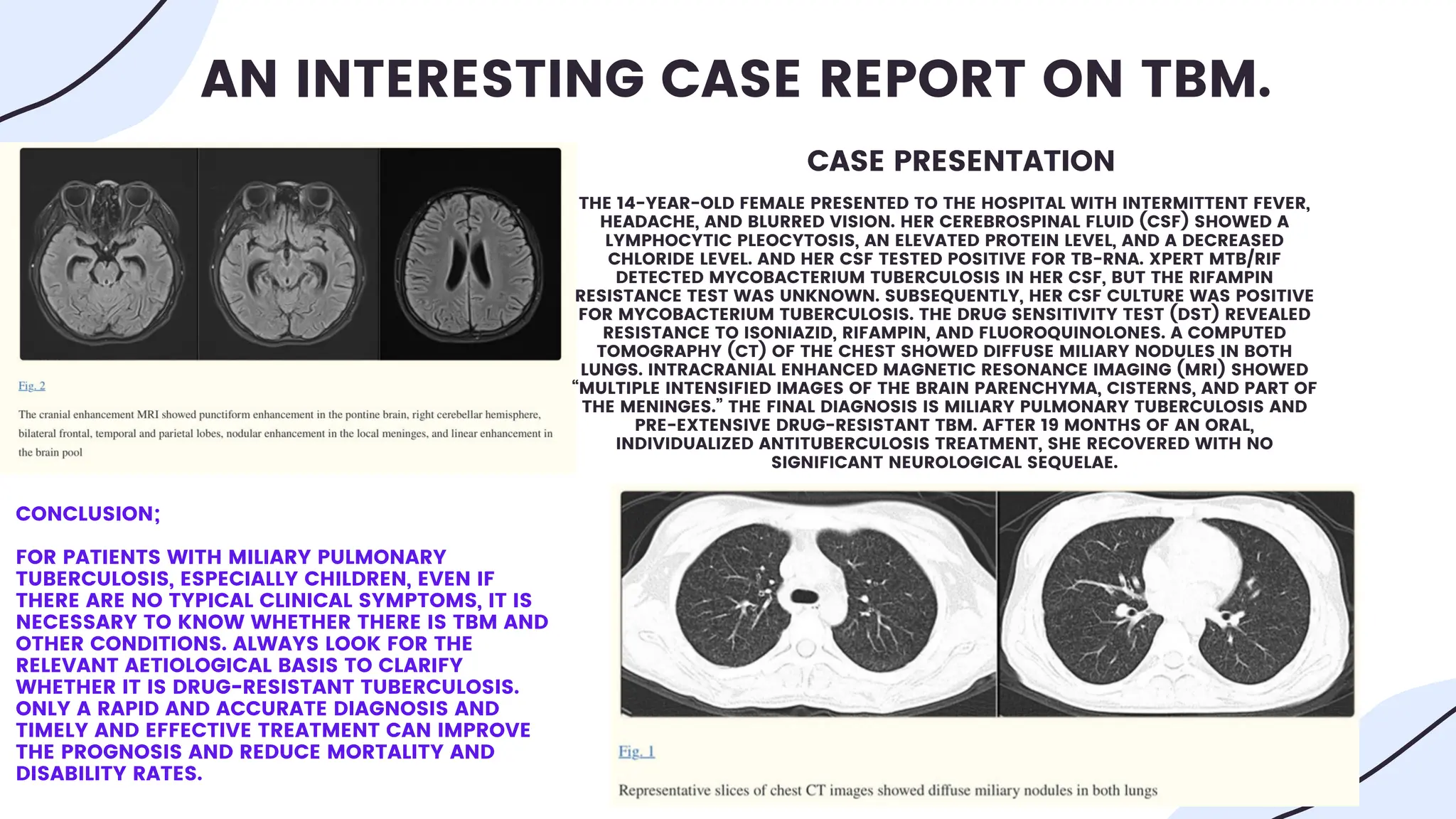 Tuberculosis in children and tubercular meningitis | PDF