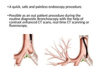 Trans-bronchial needle aspiration | Jindal Chest Clinic | PPTX
