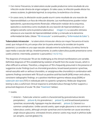 tuberculosis ocular uptodate actualizacion.pdf