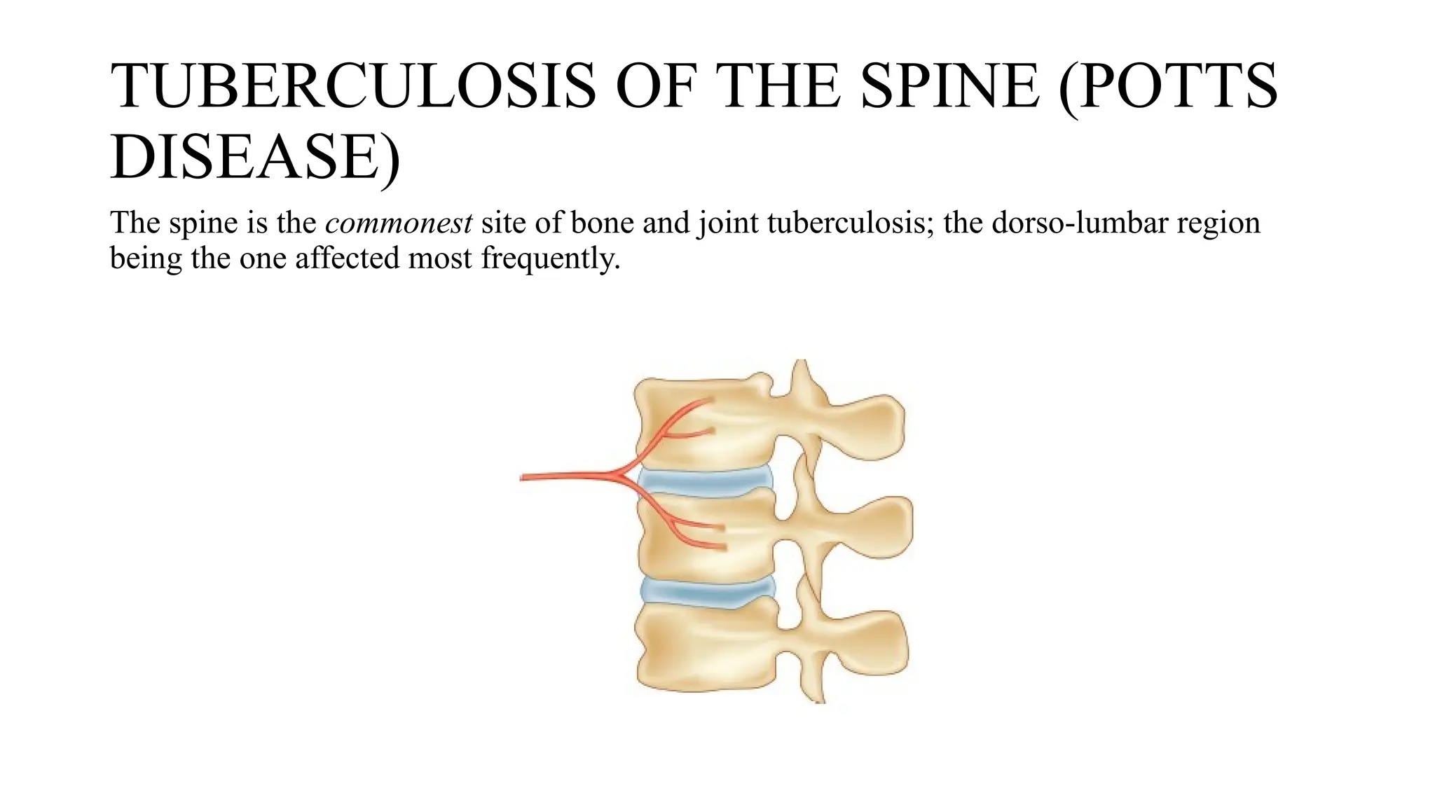 TB OF BONES AND JOINTS - ORTHOPEDICS.pptx