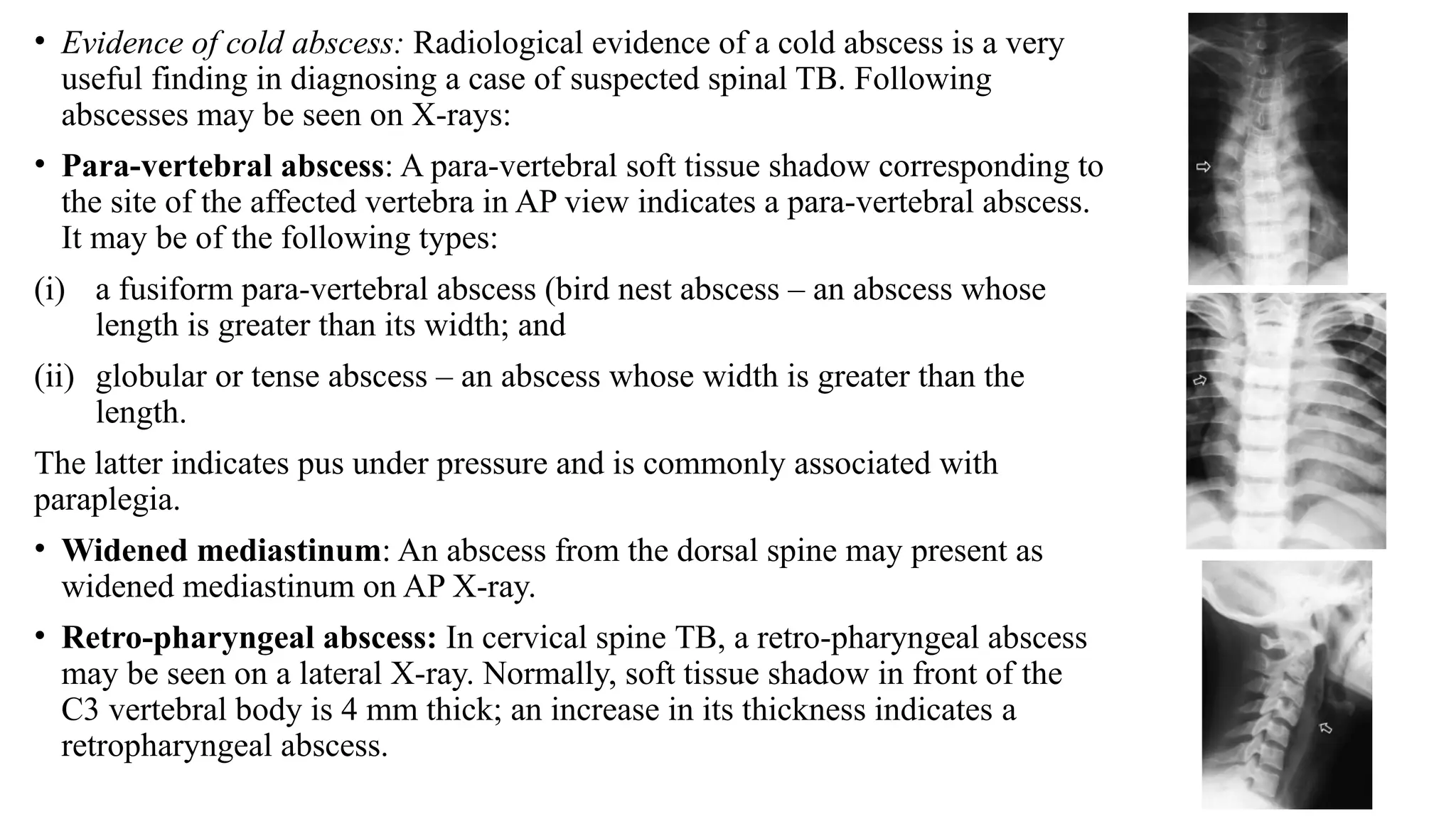 TB OF BONES AND JOINTS - ORTHOPEDICS.pptx