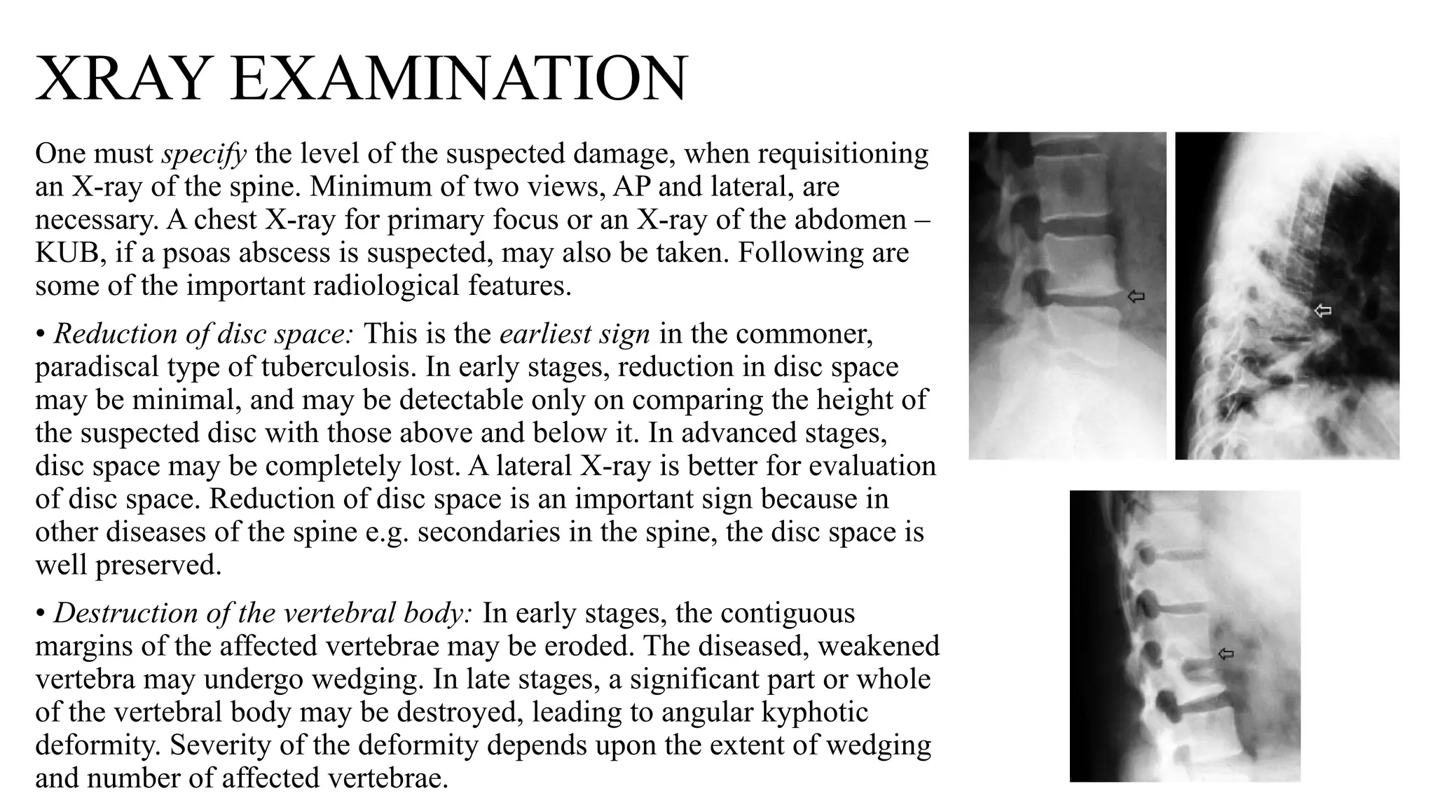 TB OF BONES AND JOINTS - ORTHOPEDICS.pptx