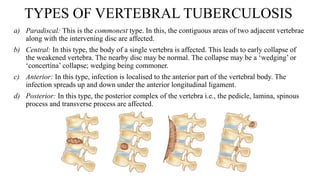 TB OF BONES AND JOINTS - ORTHOPEDICS.pptx