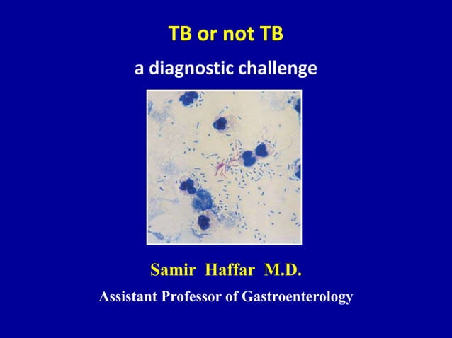 TB or not TB: a diagnostic challenge | PPT