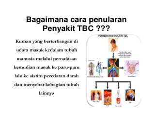 TB PARU - DETEKSI DINI DAN PENCEGAHAN TBC Copy.ppt