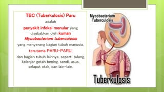 Materi penyuluhan Tuberculosis bagi kader | PPTX