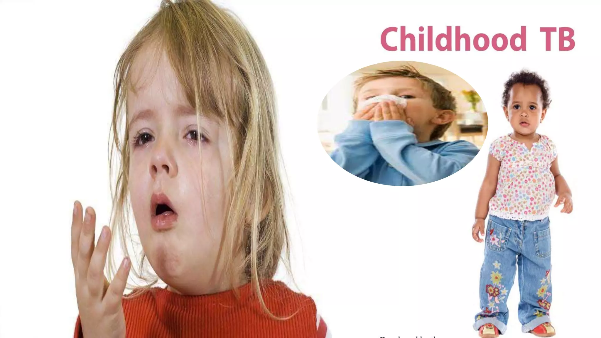 Tuberculosis in pediatrics | PPTX