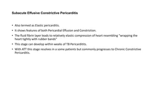 TB Pericarditis.pptx