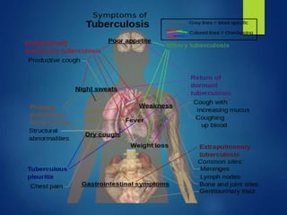 Tb presentation | PPTX | Lung and Respiratory Health | Diseases and ...