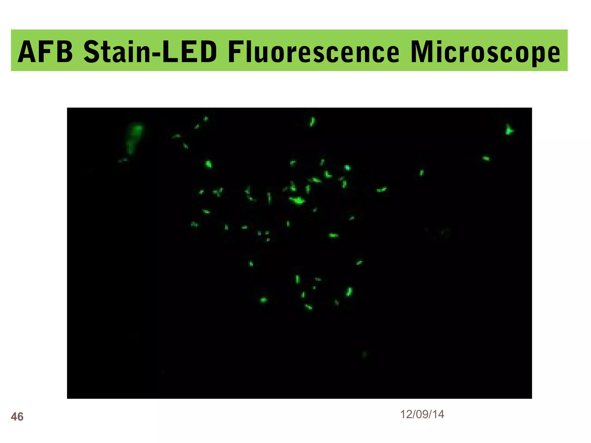 Tb presentation lab diagosis sept 2013 | PPT
