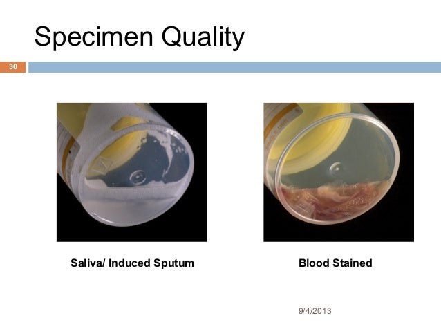 Tb presentation lab diagosis sept 2013