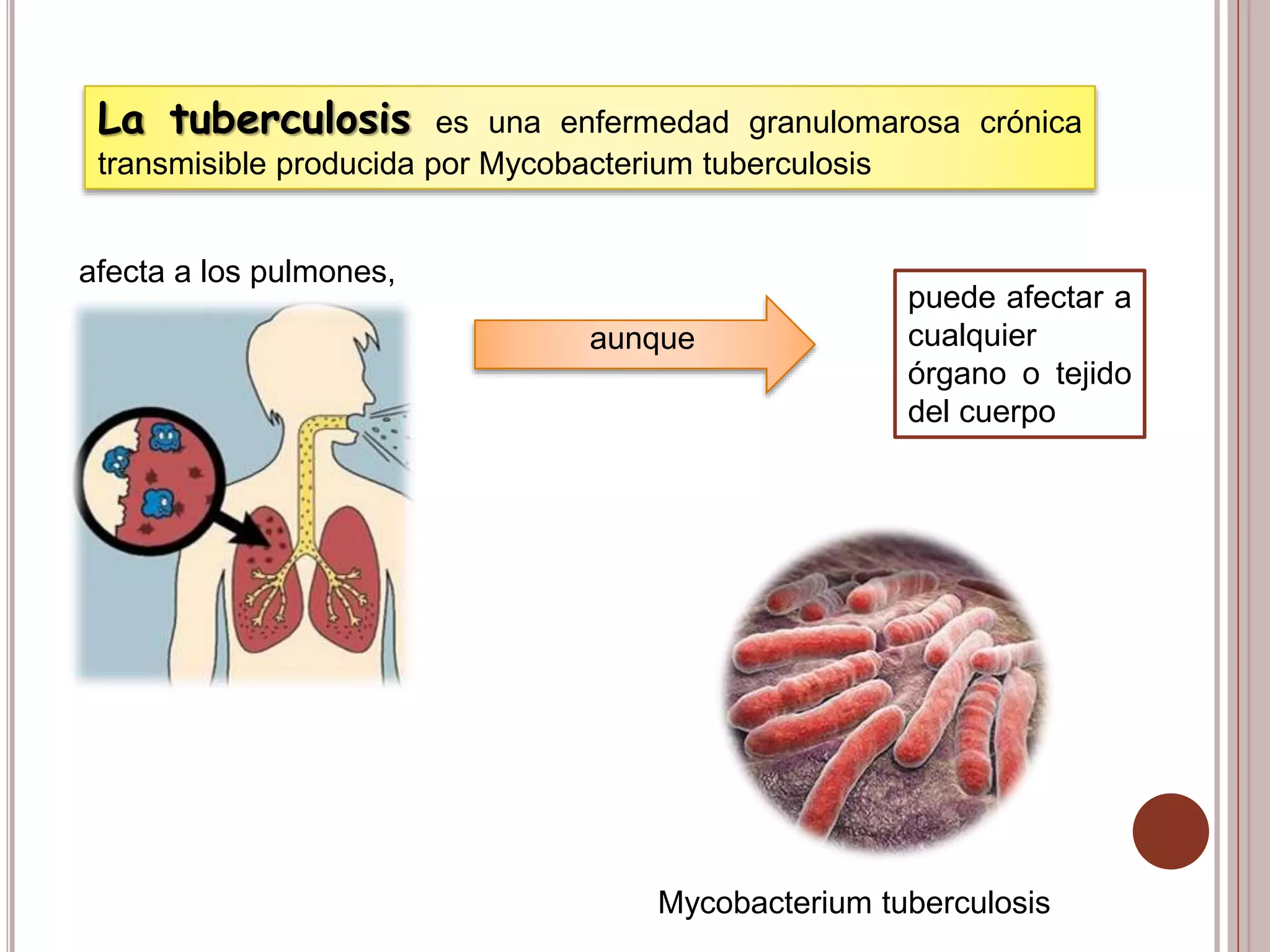 tuberculosis pulmonar | PPTX | Lung and Respiratory Health | Diseases ...