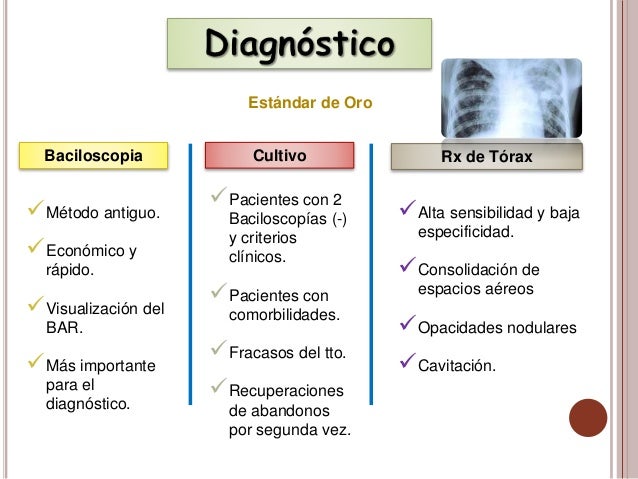 tuberculosis pulmonar