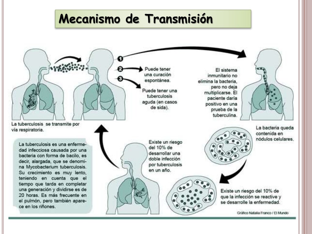 tuberculosis pulmonar