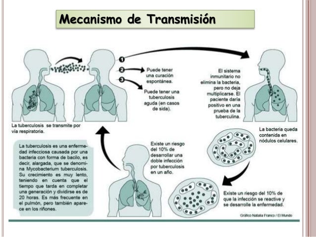 tuberculosis pulmonar