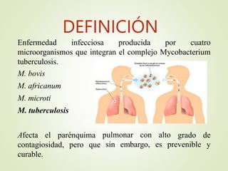 TB PULMONAR diagnostico trtamuento clinica | PPTX | Lung and ...
