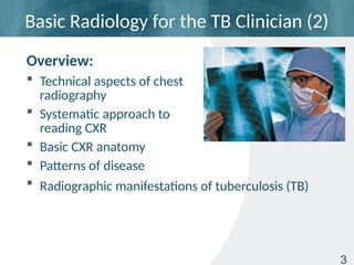 tb_radiology_basic_presentation_slides.pptx