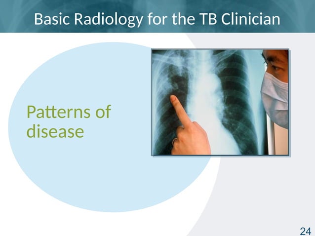 tb_radiology_basic_presentation_slides.pptx