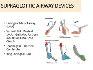 TBR Airway Management.pptx