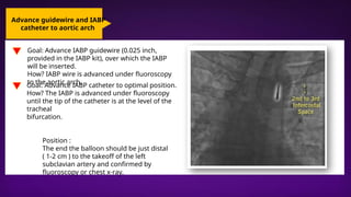 text book reading stase Cathlab - IABP.pptx