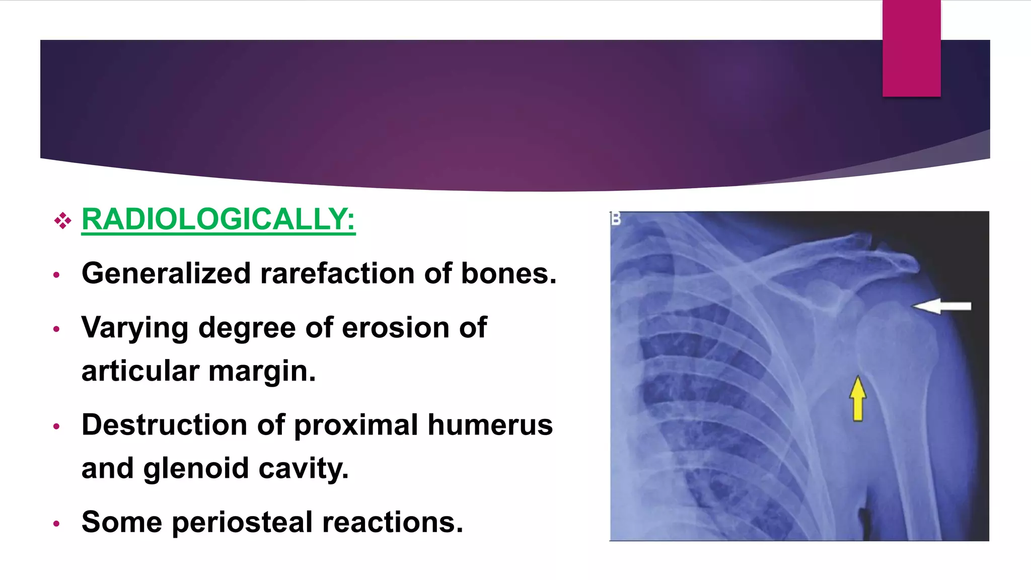 TB shoulder,elbow,wrist,short tubular bones(fingers,toes) | PPTX