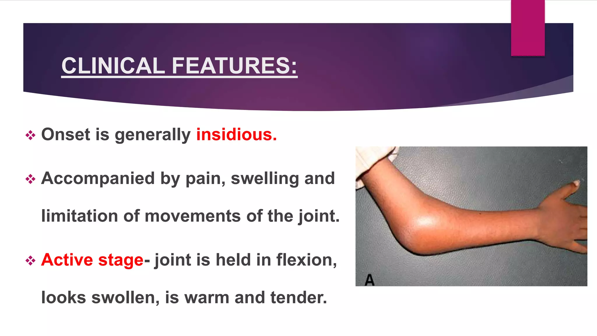 TB shoulder,elbow,wrist,short tubular bones(fingers,toes) | PPTX