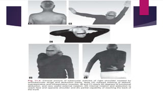 TB shoulder,elbow,wrist,short tubular bones(fingers,toes) | PPTX