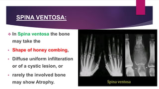 TB shoulder,elbow,wrist,short tubular bones(fingers,toes) | PPTX