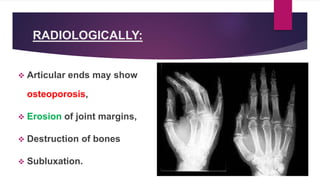 TB shoulder,elbow,wrist,short tubular bones(fingers,toes) | PPTX