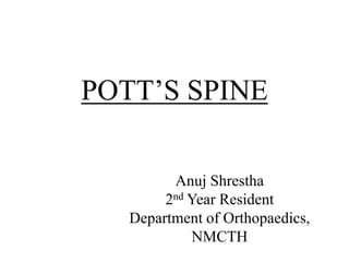 Understanding Pott's Spine | PPT