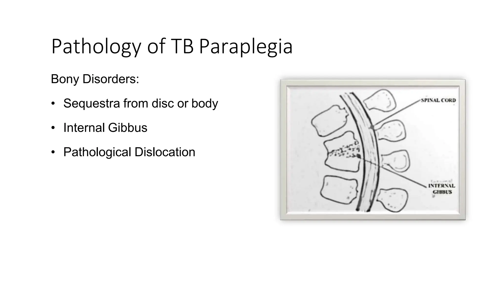 TB SPINE.pptx
