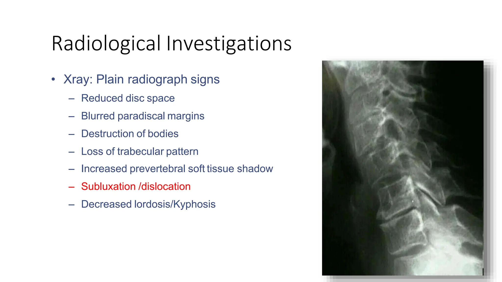 TB SPINE.pptx