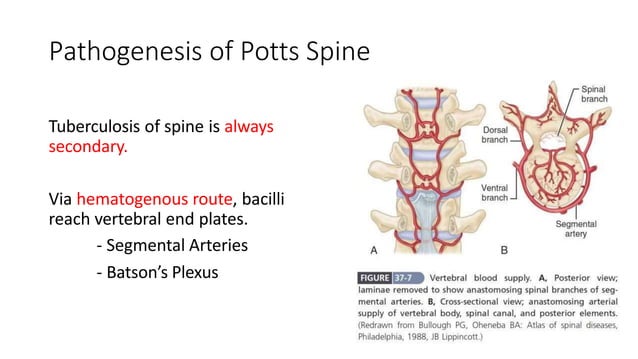 TB SPINE.pptx | Bone and Joint Conditions | Diseases and Conditions