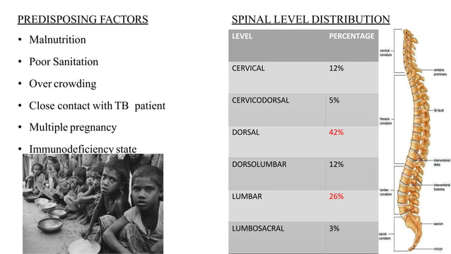 TB SPINE.pptx | Bone and Joint Conditions | Diseases and Conditions